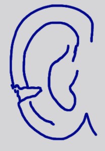 Ear Lacerations, Part I – Closing the Gap