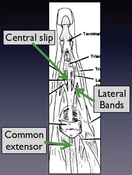 Extensor Tendon Injuries: PIP & Elson’s Test – Closing the Gap