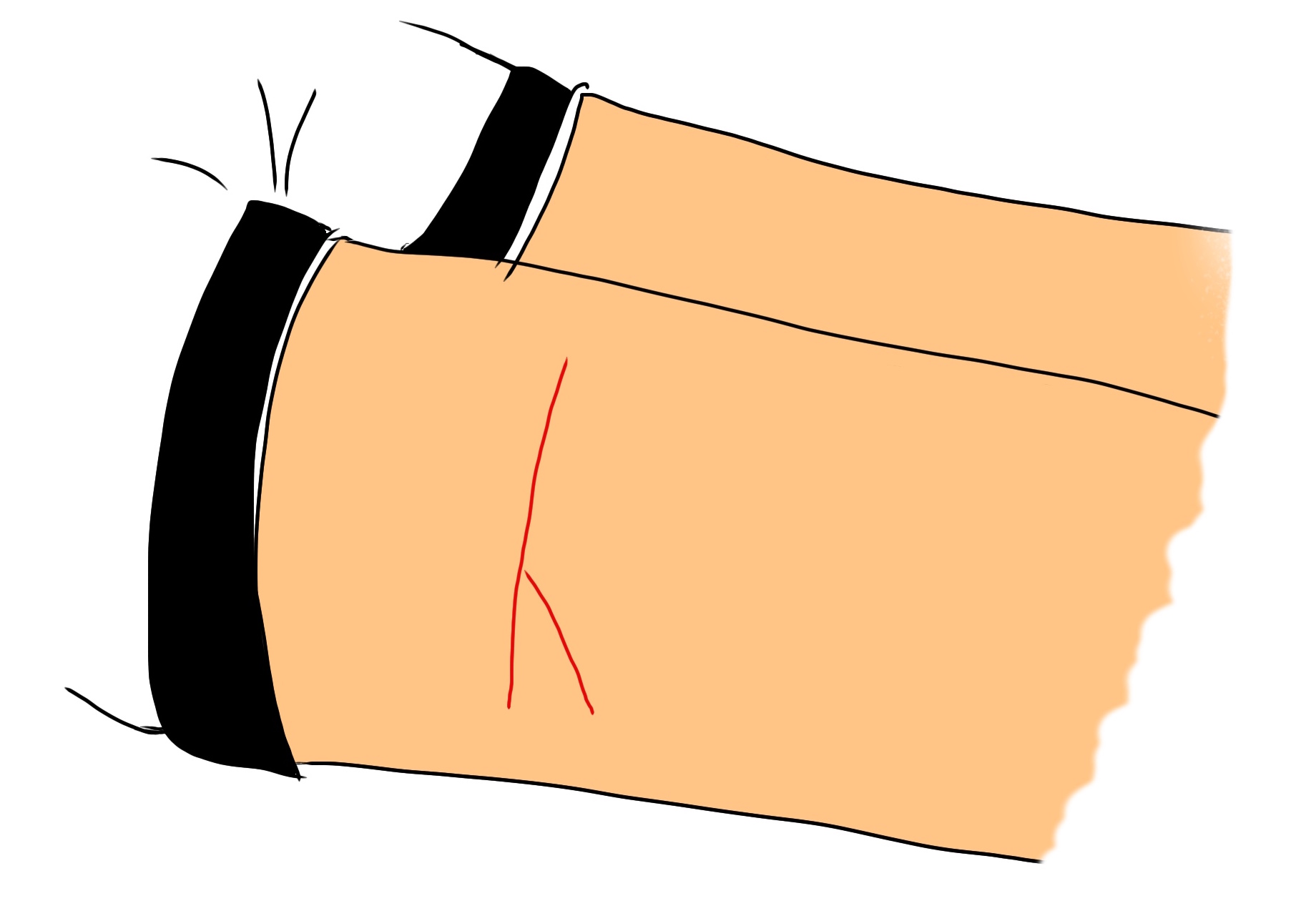 Wound Blog – Closing the Gap