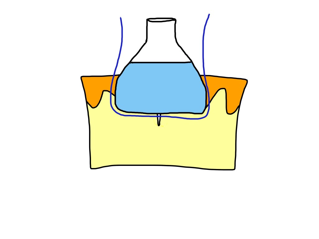 The Perfect Simple Interrupted Suture – Closing the Gap