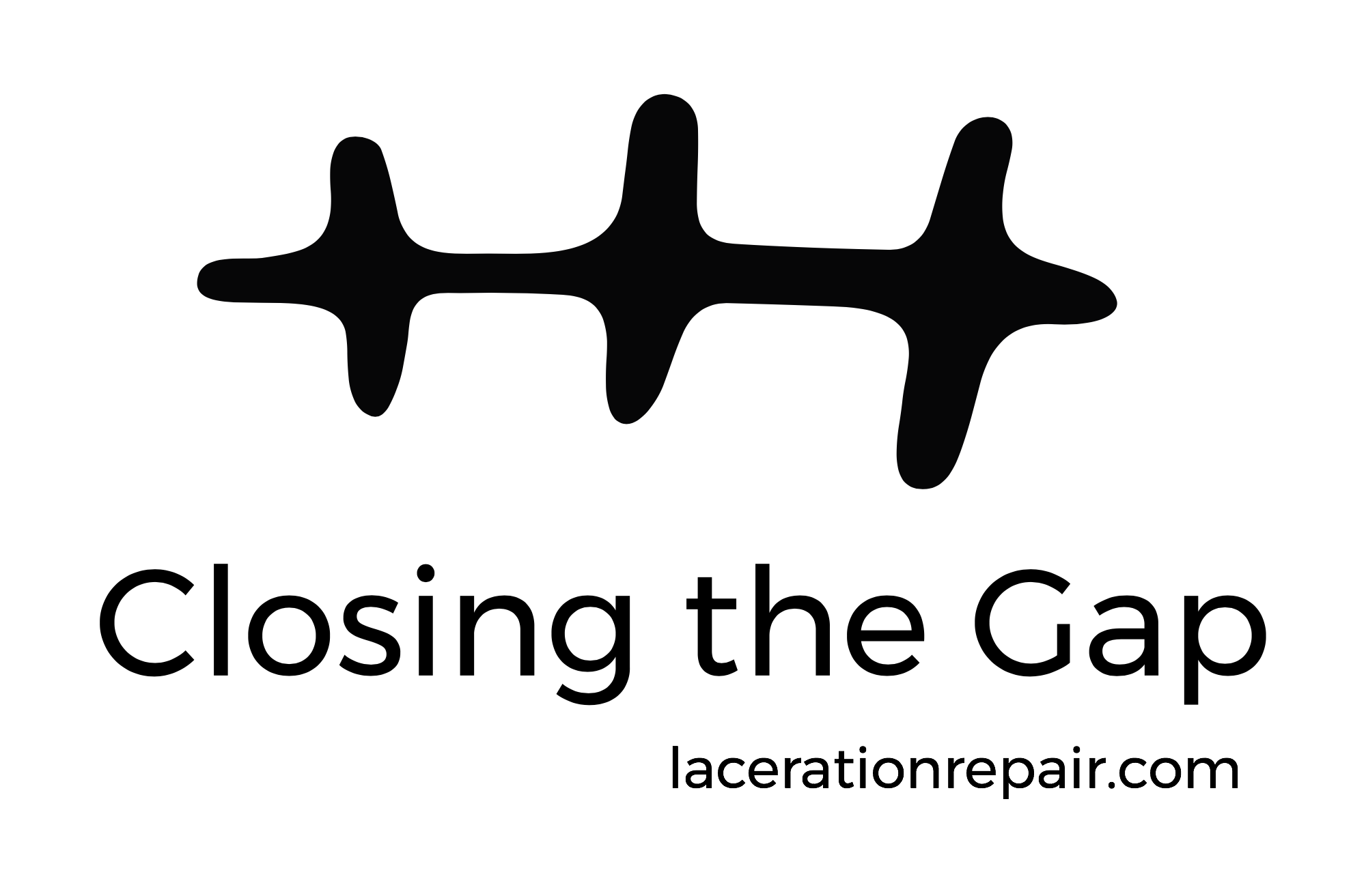 “Loose” Closure – Closing the Gap