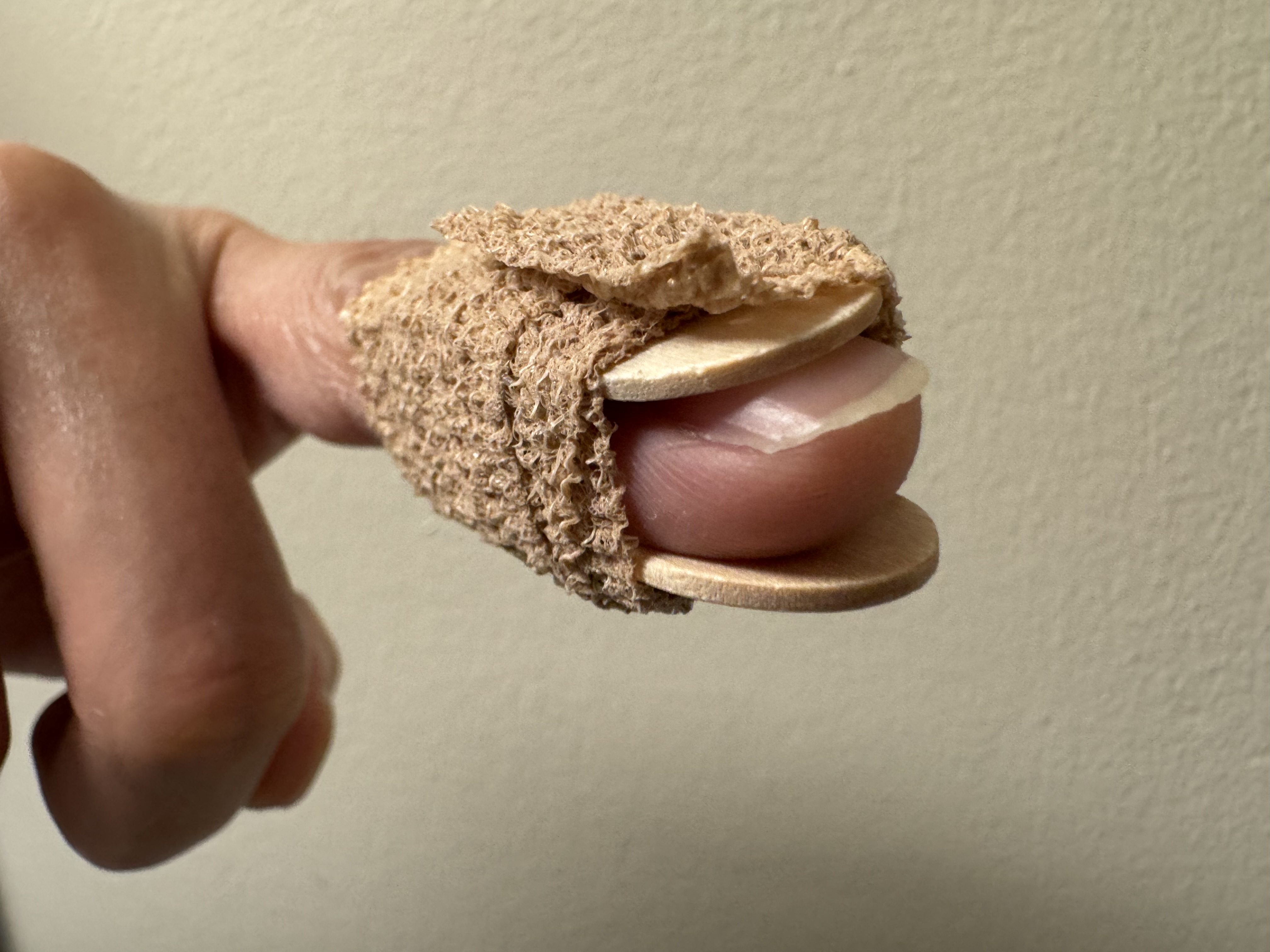 Tuft Fractures, Part I – Closing the Gap